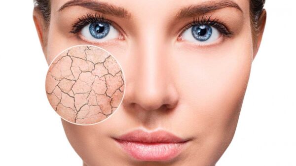 Piel seca VS piel deshidratada ¿Cómo distinguirlas? - Clínica Pilar de ...