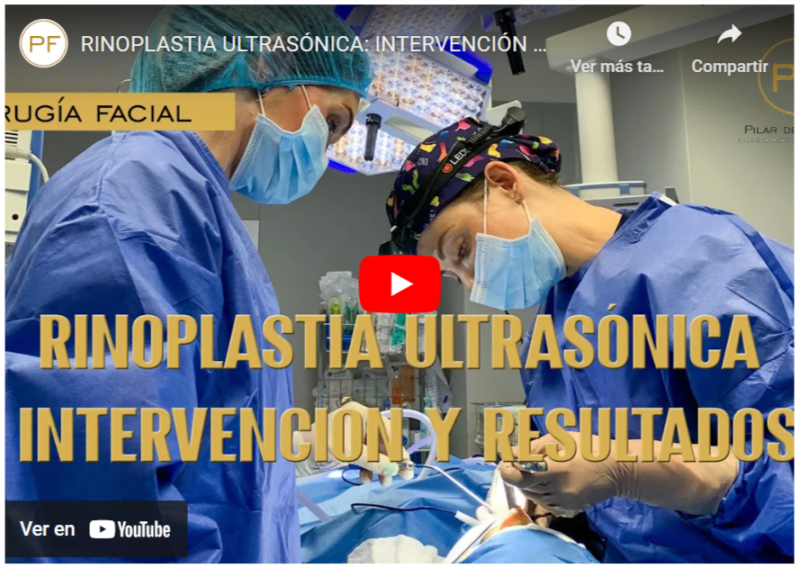 Cómo conseguir una nariz perfecta | Pilar de Frutos